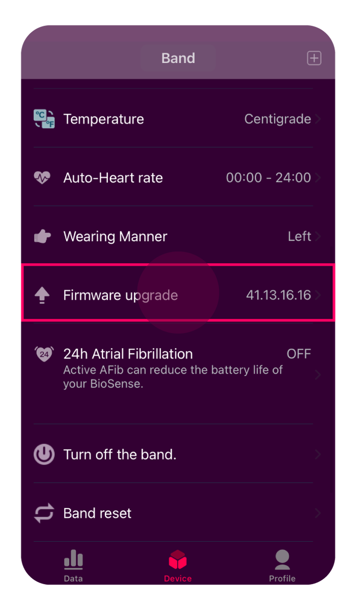 How Can I Upgrade The Device Firmware